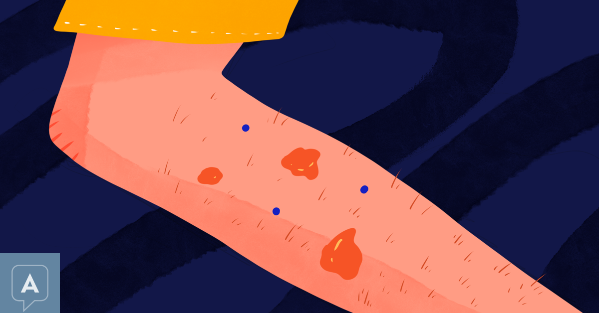 Types Of Allergy Tests And How They Work | Asthma.net